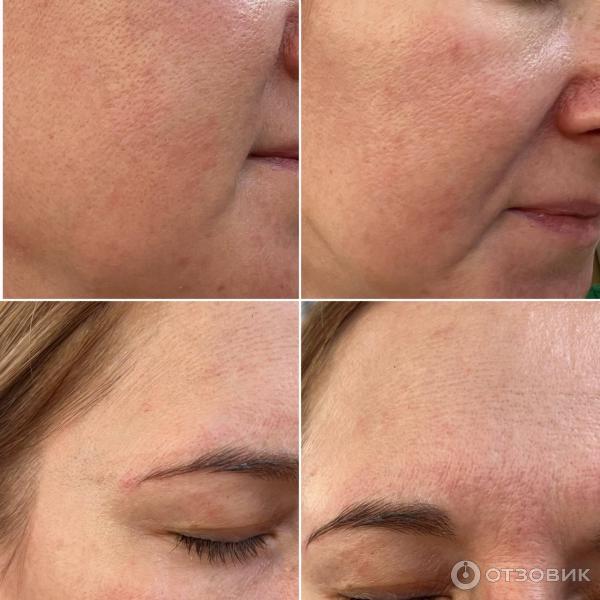 Отзыв о Солнцезащитный крем 3 в 1 Vichy Capital Soleil с антивозрастным ...